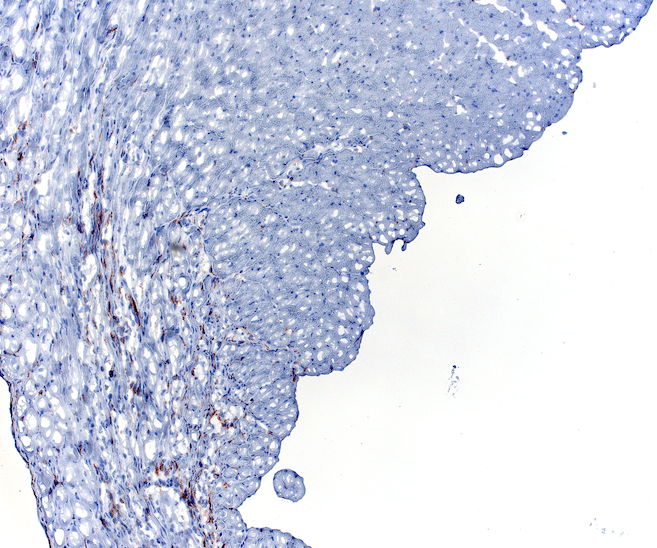 Hands-on: Quantitative Analysis of Histological Staining Using Color ...