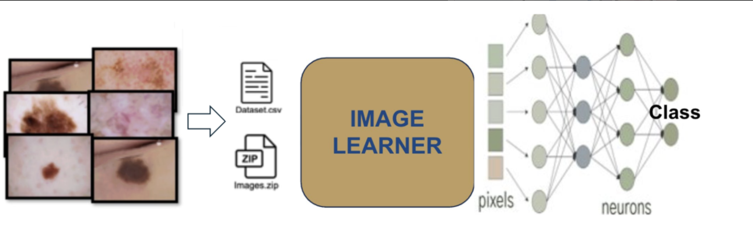 Hands-on: GLEAM Image Learner - Validating Skin Lesion Classification ...